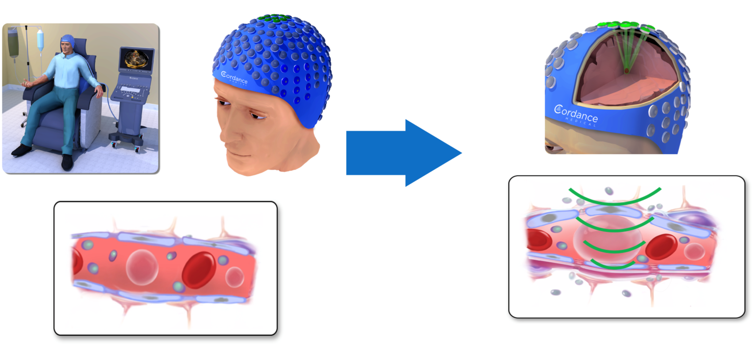 Our Solution » Cordance Medical