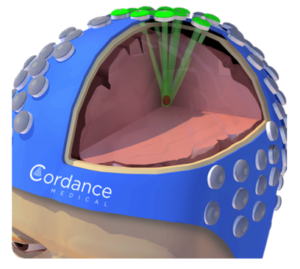 Our Solution » Cordance Medical